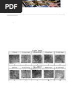 Henry Classification System With FBI Modifications | PDF | Fingerprint ...