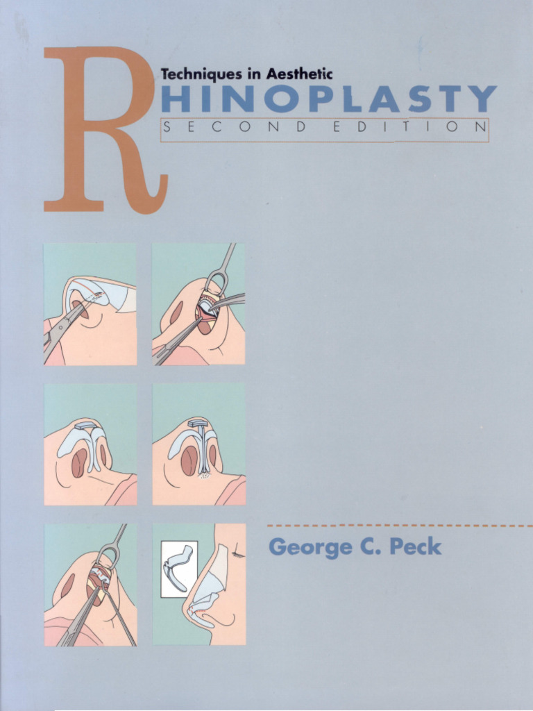 Techniques in Aesthetic Rhinoplasty | PDF
