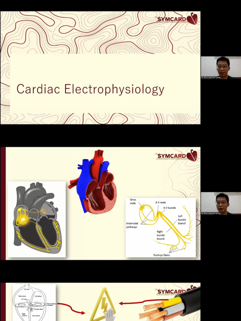 Ekg | PDF
