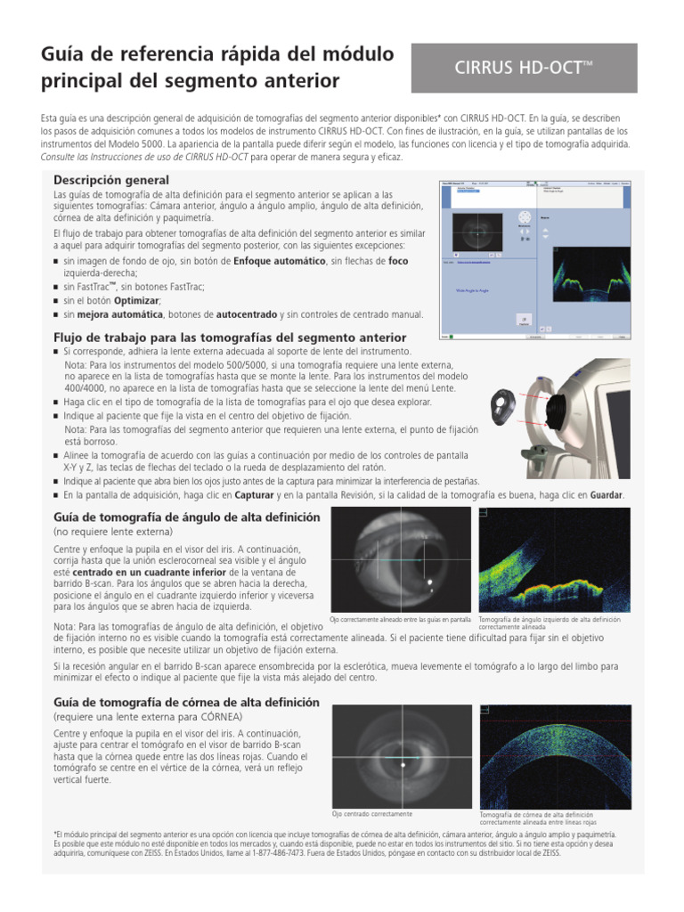 Quick Guide CIRRUS Anterior Segment - Spanish | PDF | Córnea | Ojo