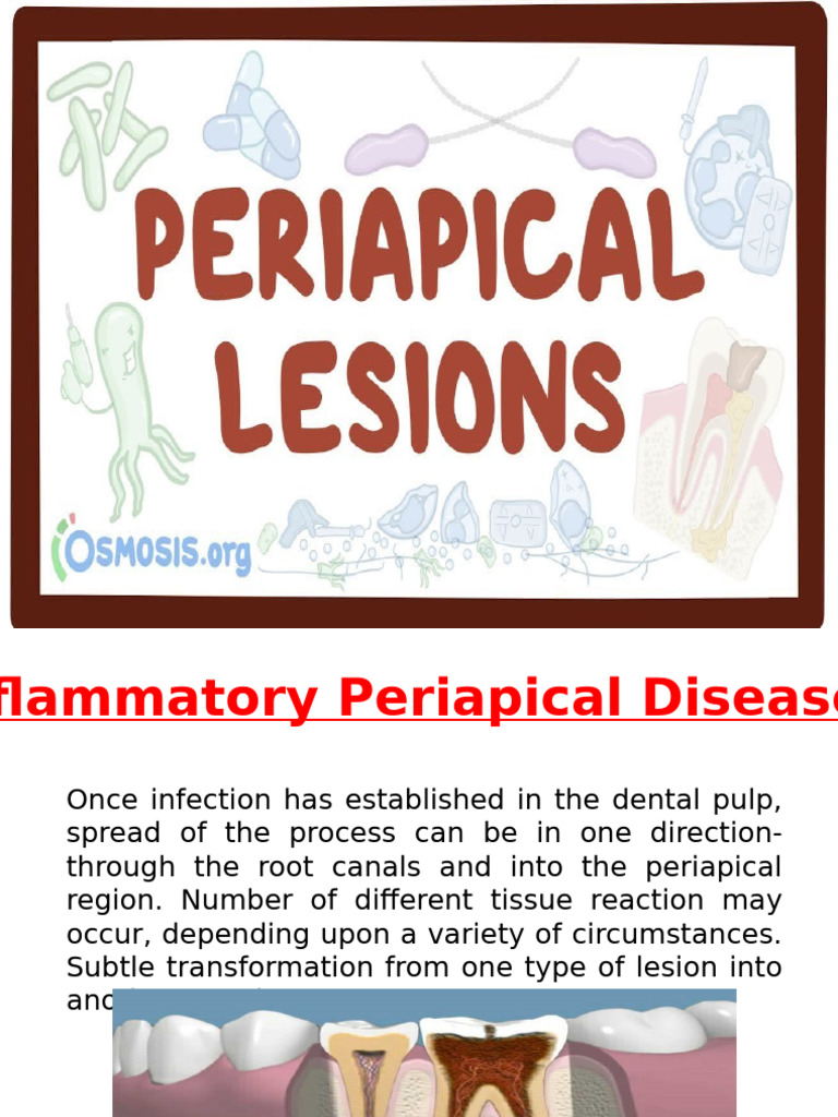 Periapical Diseases 2025 | PDF | Inflammation | Human Tooth
