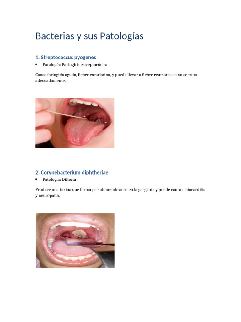 Streptococcus en la boca y sus efectos | PDF | Diarrea | Meningitis