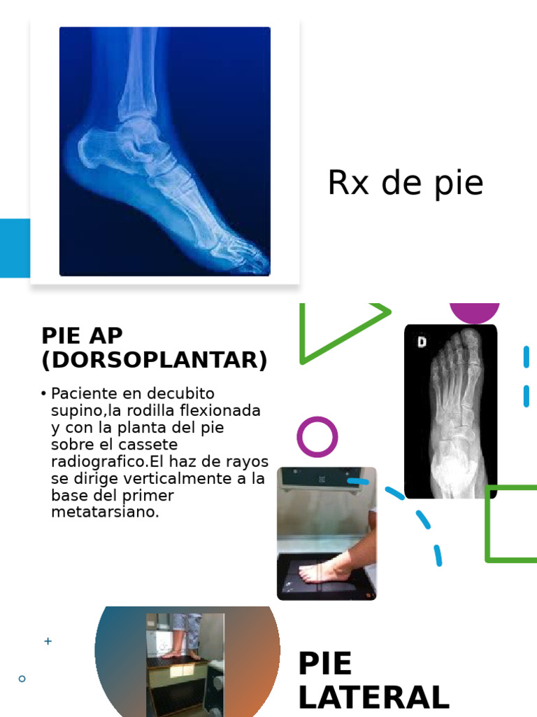 RX de Pie | PDF | Pie | Extremidades (anatomía)