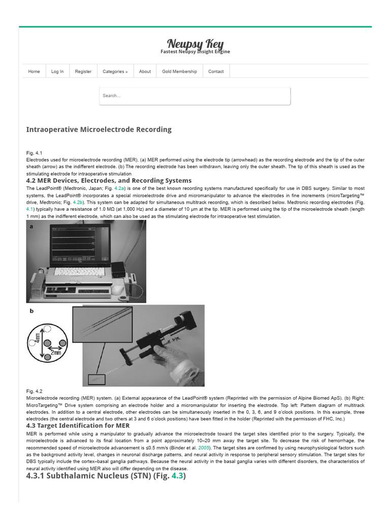 Microelectrode Recording in DBS Surgery | PDF | Deep Brain Stimulation ...