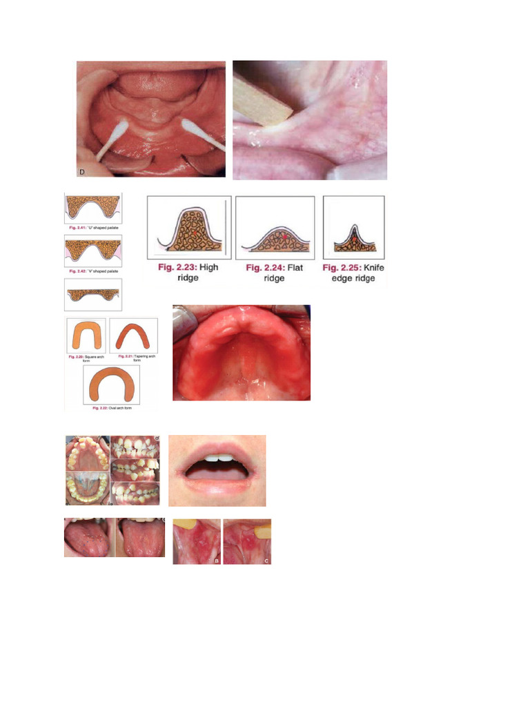Print LB SK 1 | PDF