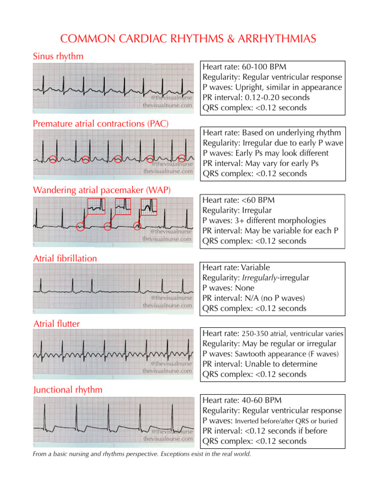 Common Cardiac Rhythms Overview | PDF | Heart | Cardiac Electrophysiology
