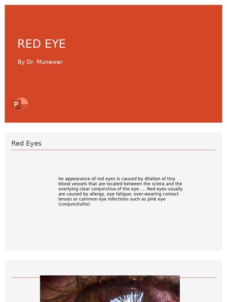 RED EYE by Dr. Munawar | PDF