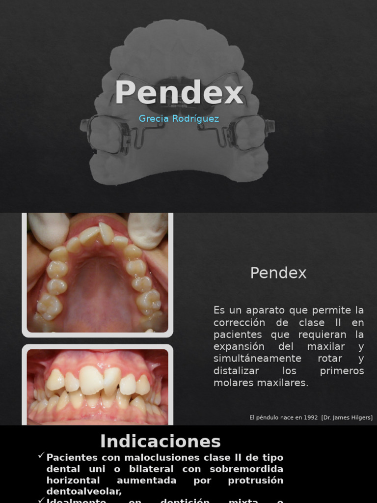 Uso y ventajas del péndulo Pendex en ortodoncia | PDF | Boca | Diente