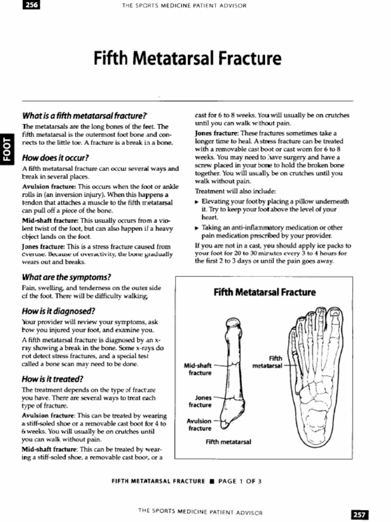 Foot Fifth 5th Metatarsal Fracture | PDF