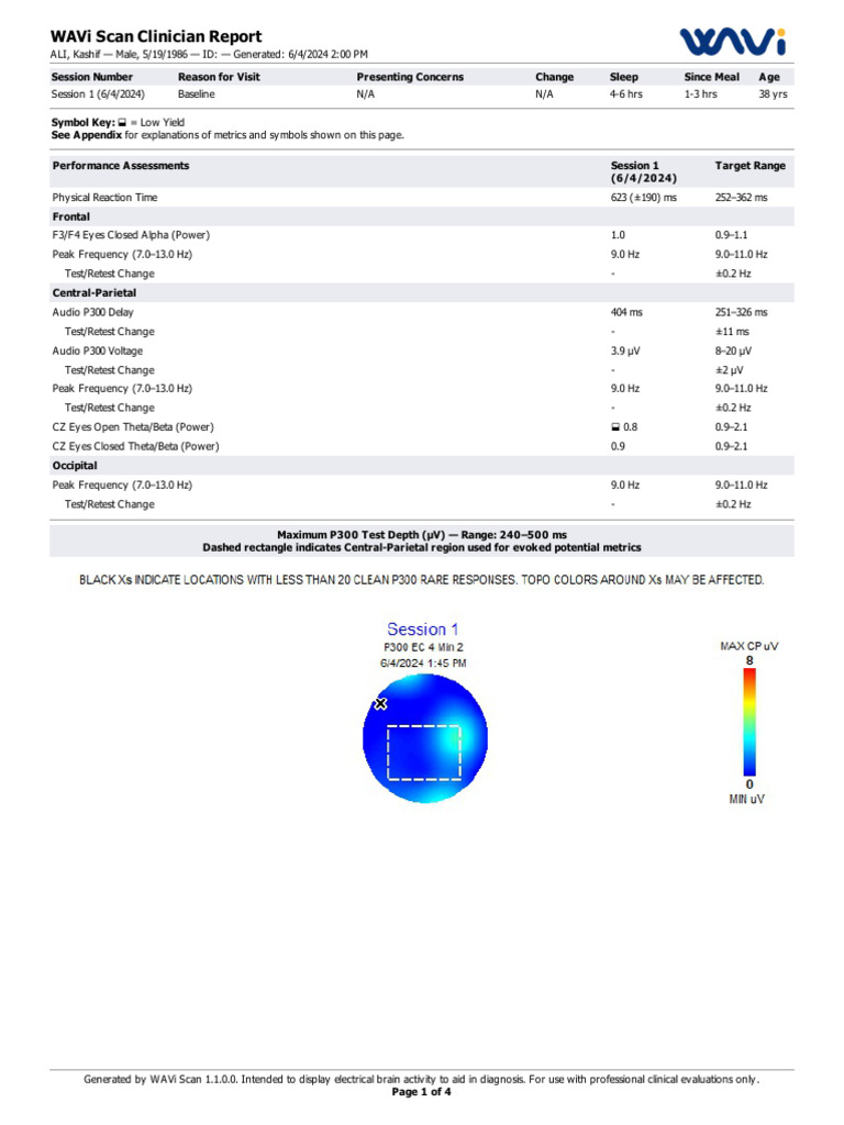 (Internal) WAVI Scanclinician | PDF | Electroencephalography | Neuroscience