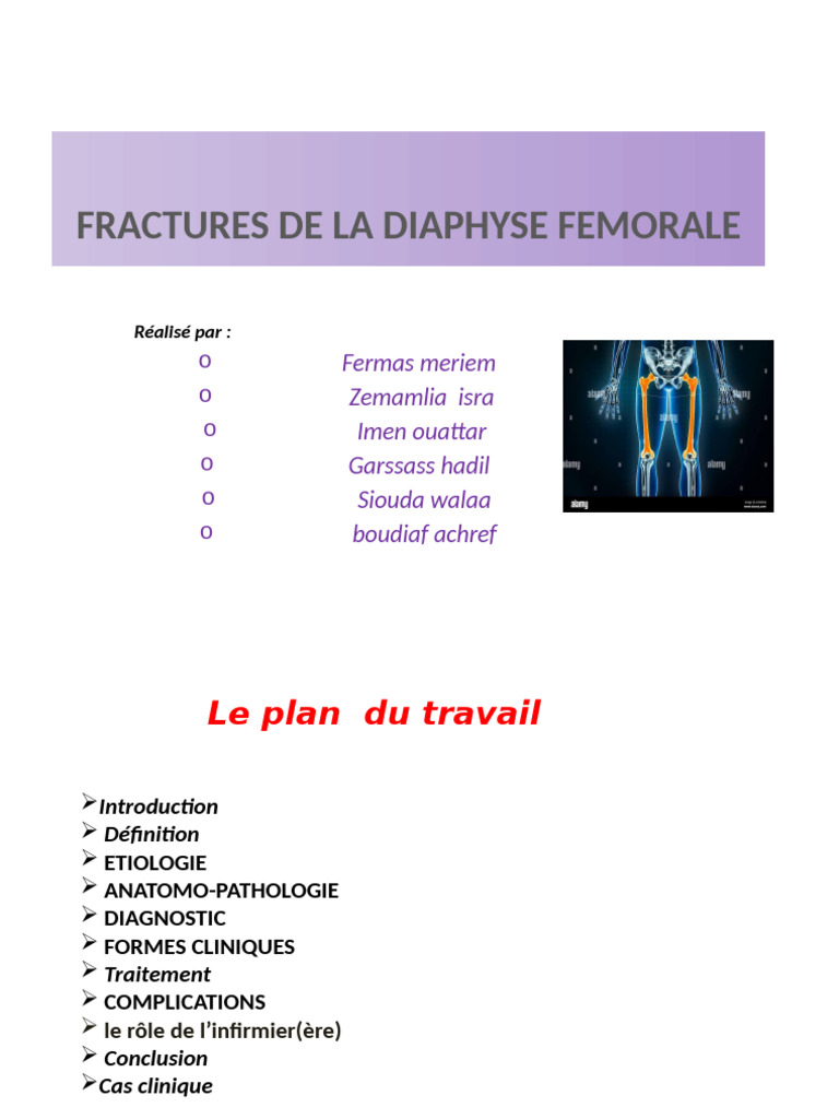 Fractures de la diaphyse fémorale | PDF | Maladies et troubles ...