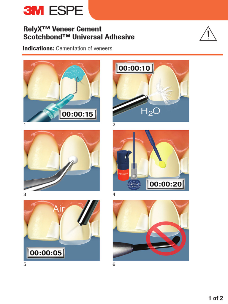 RelyX Veneer Cement Instructions | PDF