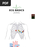 Delta Wave - LITFL Medical Blog - ECG Library Basics | PDF | Cardiac Electrophysiology ...