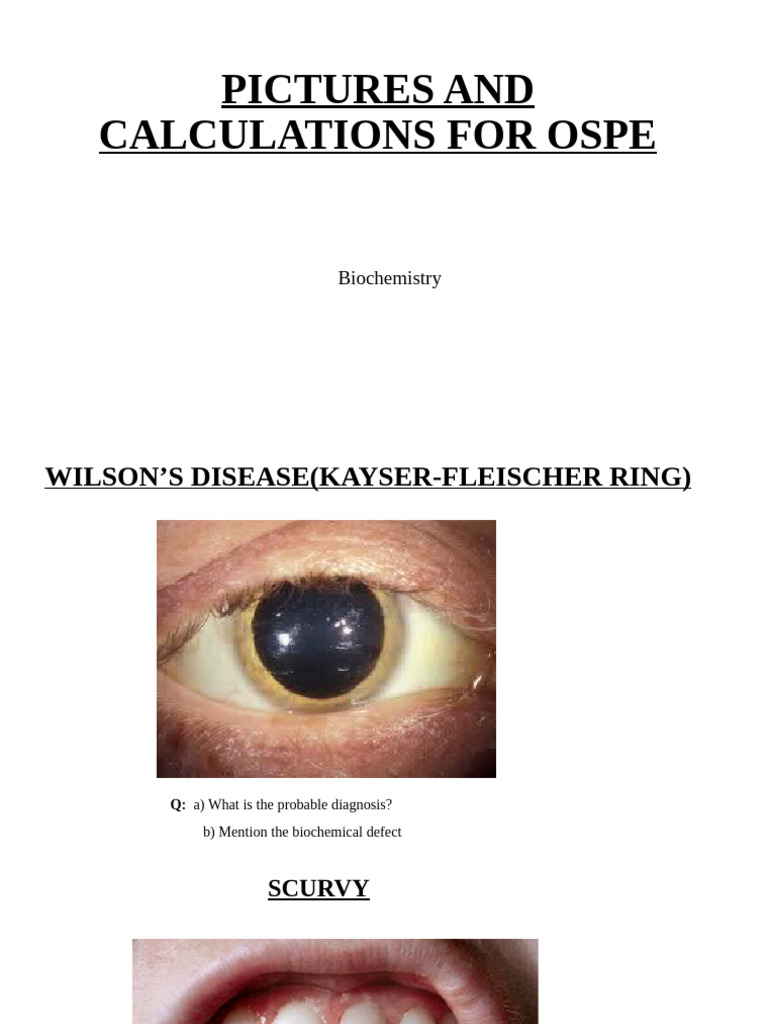GTT Curves and Pictures For Ospe 2024-2025 Batch April Month 2nd Internals | PDF