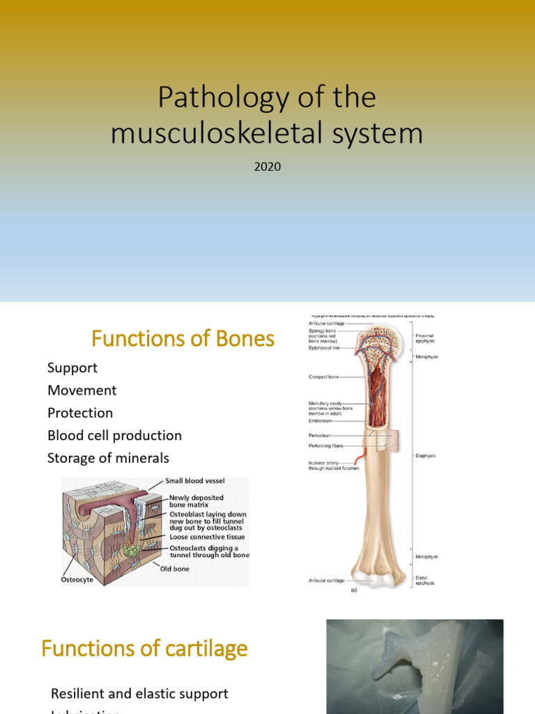 7 Pathology of The Musculoskeletal System | PDF | Bone | Arthritis