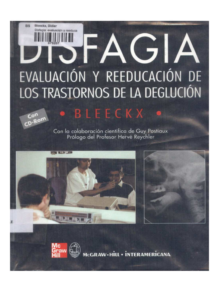 Disfagia - Bleeckx | PDF