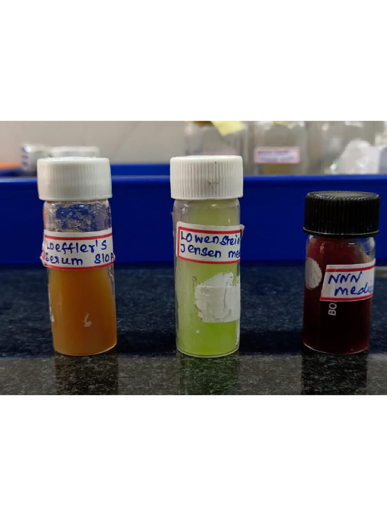 Micro Spotters | PDF