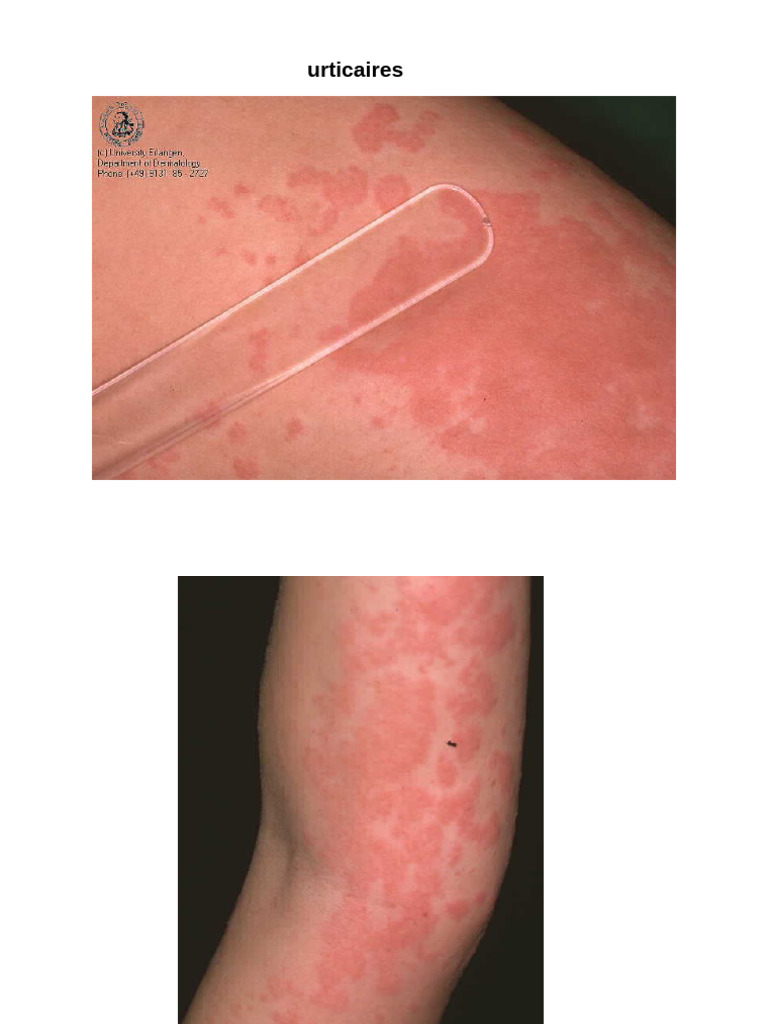 Dermatoze alergice francezi | PDF