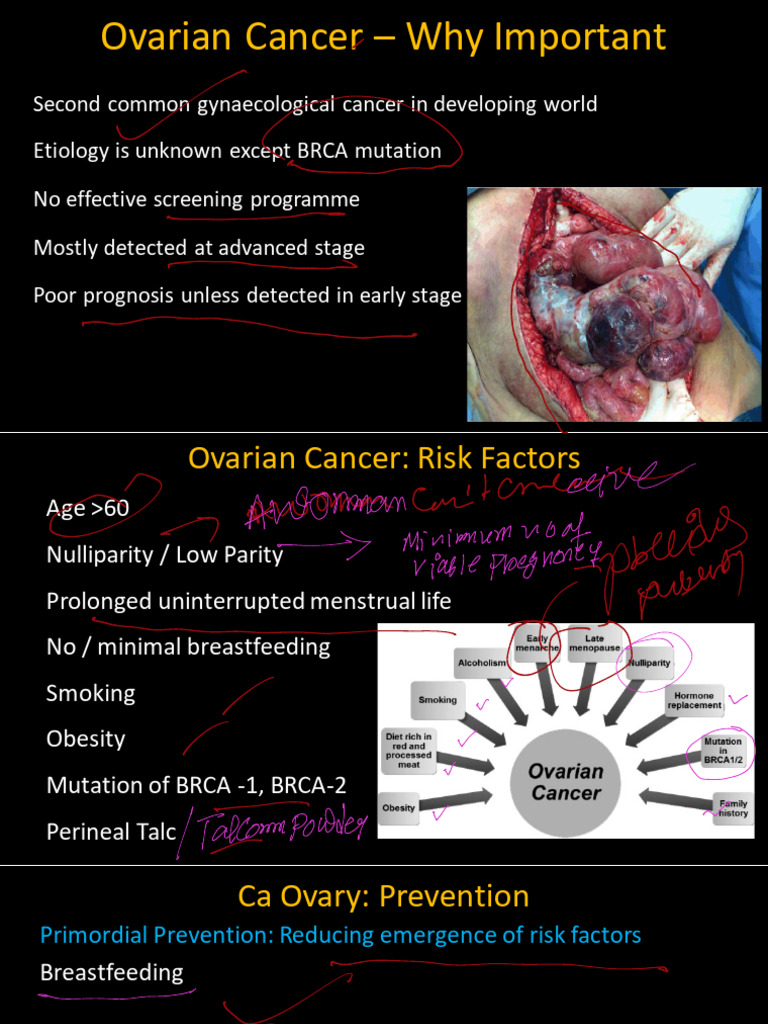 Ovarian Cancer Notes | PDF