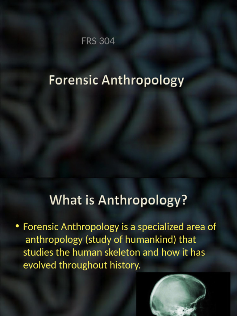 Forensic Anthropology: Bone Identification Techniques | PDF | Bone ...