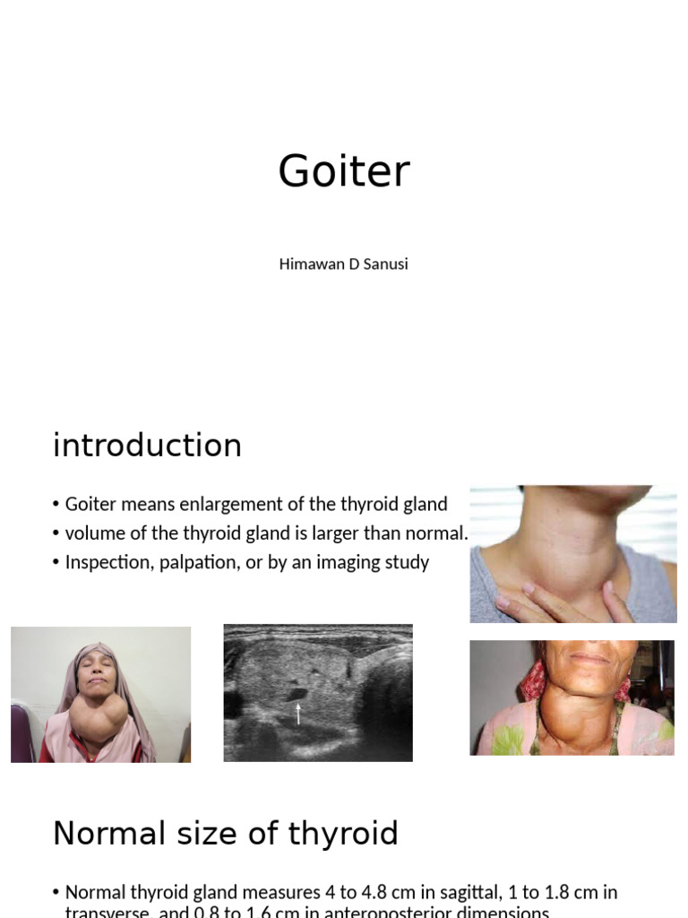Goiter 1 | PDF | Thyroid | Thyroid Stimulating Hormone