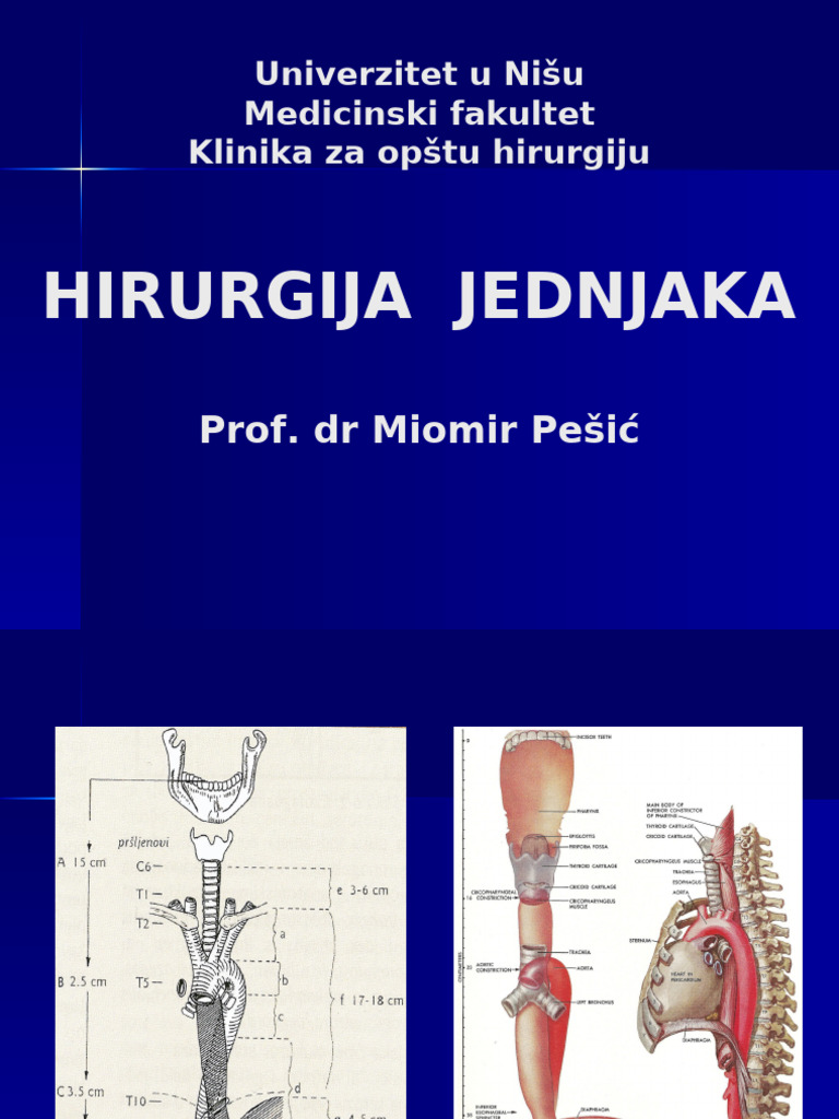 Prezentacija HIRURGIJA JEDNJAKA | PDF