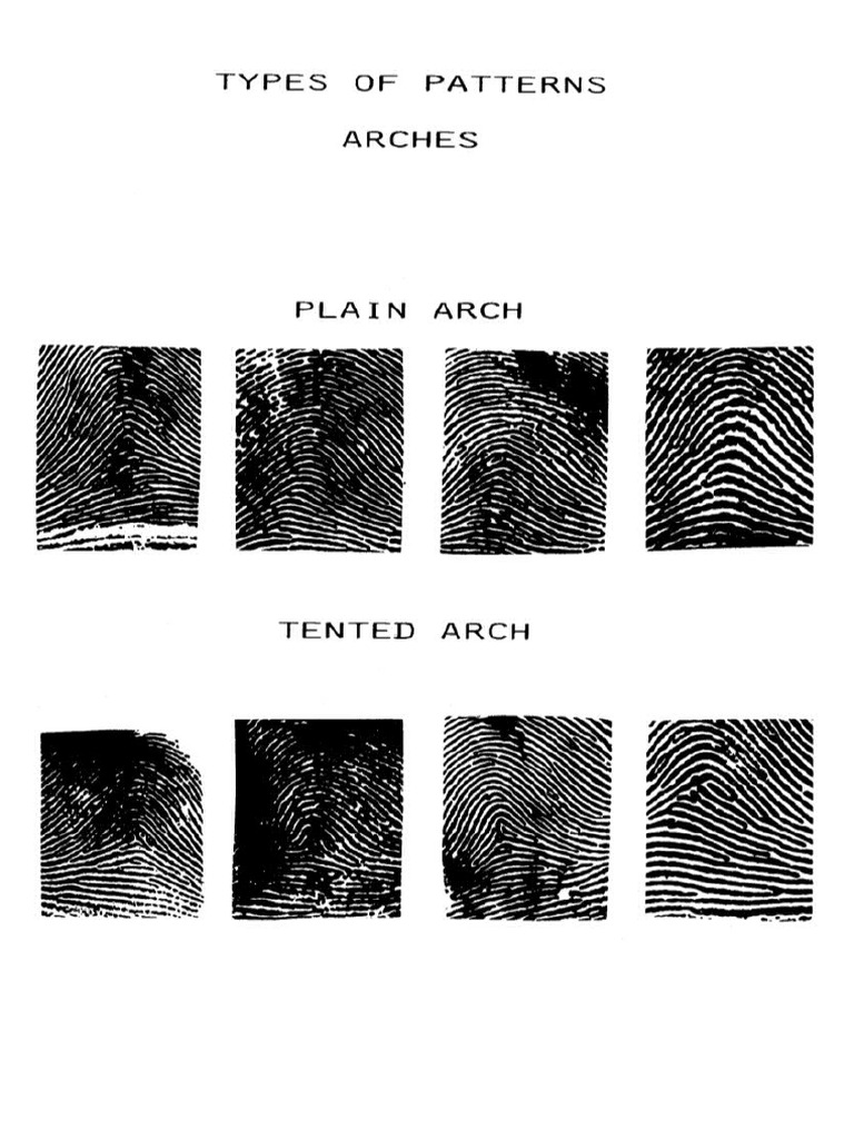 Types of Fingerprint Patterns | PDF