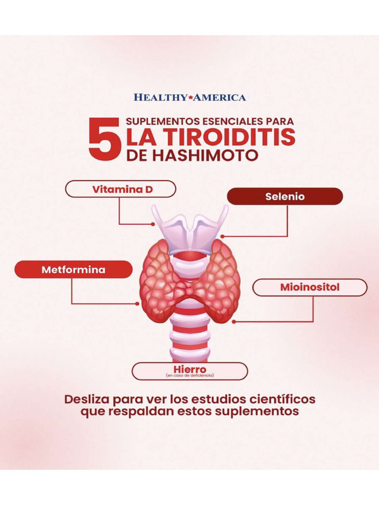 Tiroiditis de Hashimoto | PDF