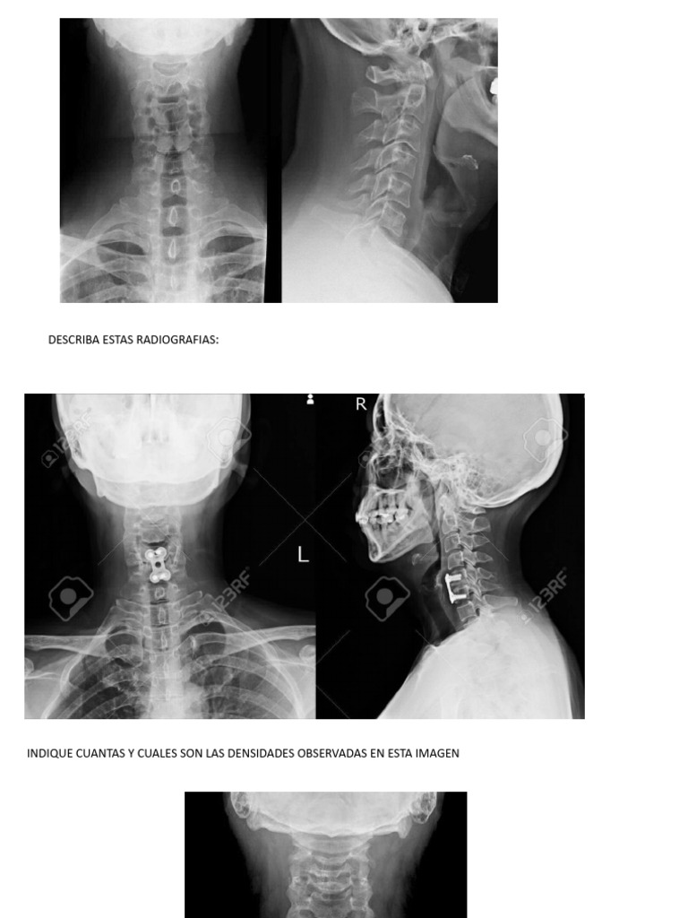 DIAPO RX DE COLUMNA | PDF