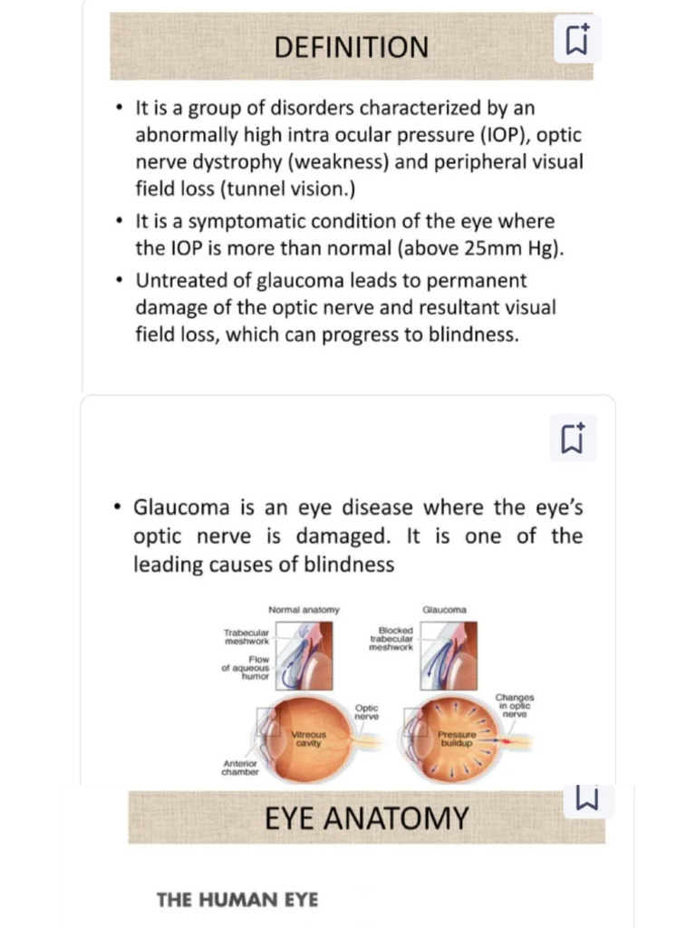 Glaucoma | PDF