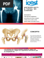 Protesis de Thompson Espanol SCECLE | PDF | Cirugía | Medicina CLINICA