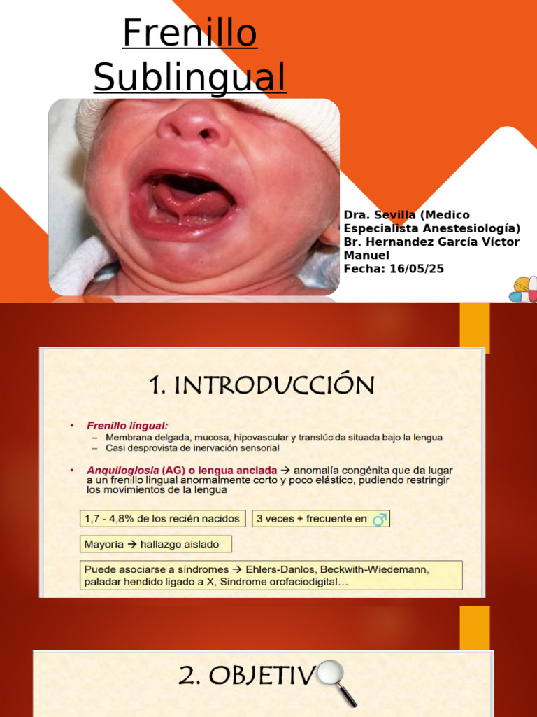 Frenillo Sublingual ORL (2) | PDF