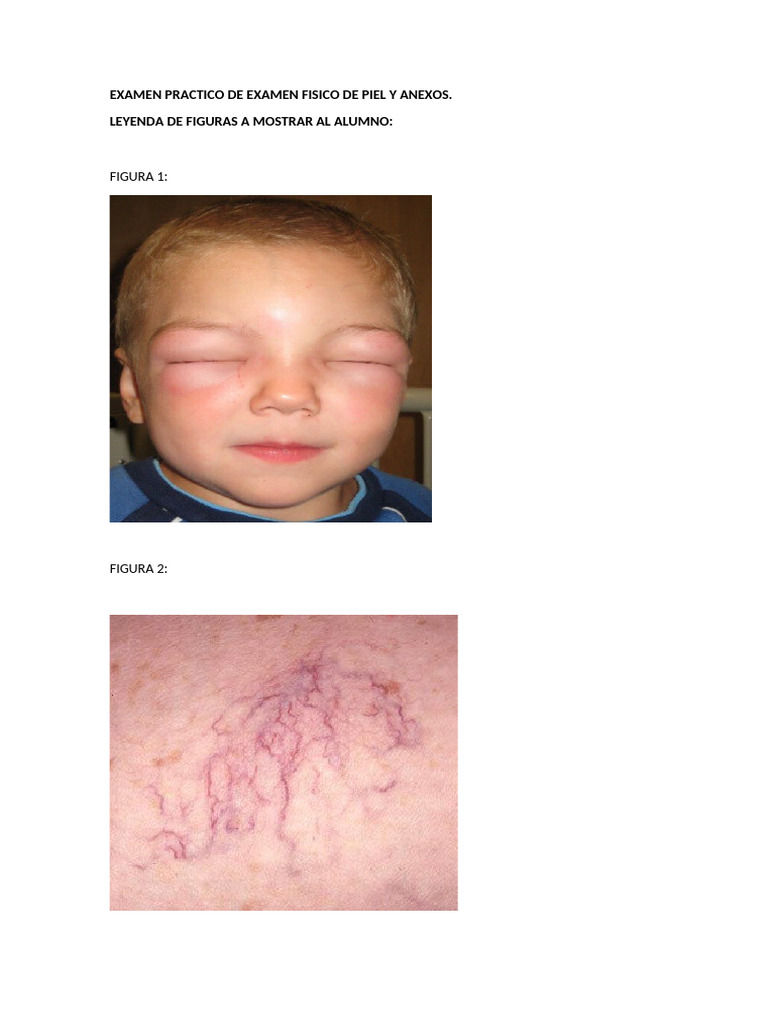ROTACION 2 - IMAGENES-Evaluaciขn pr ctica-PIEL y ANEXOS- Semiologกa 2022 | PDF
