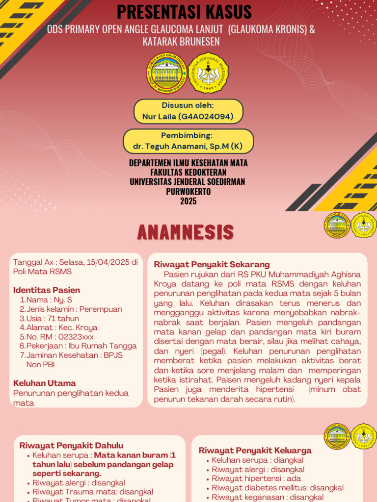 PPT PRESENTASI KASUS MATA_GLAUKOMA KRONIK_NUR LAILA | PDF