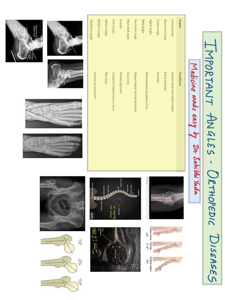 Angles in Ortho | PDF