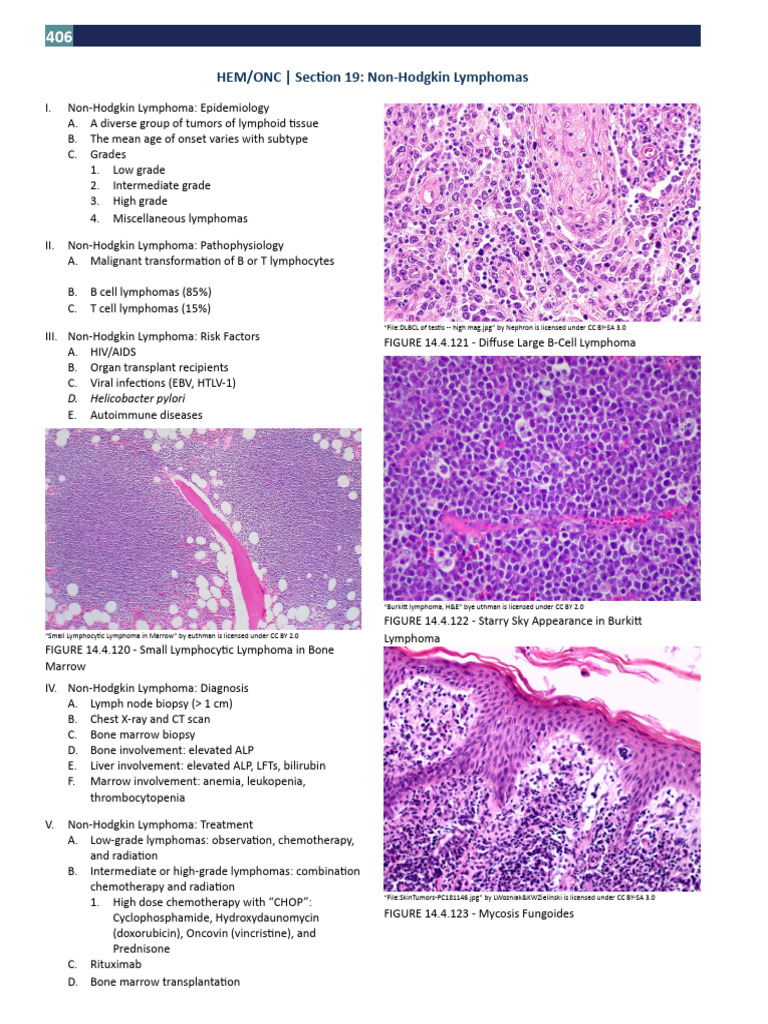 Section 19 - Non-Hodgkin Lymphomas | PDF | Lymphoma | Immunology