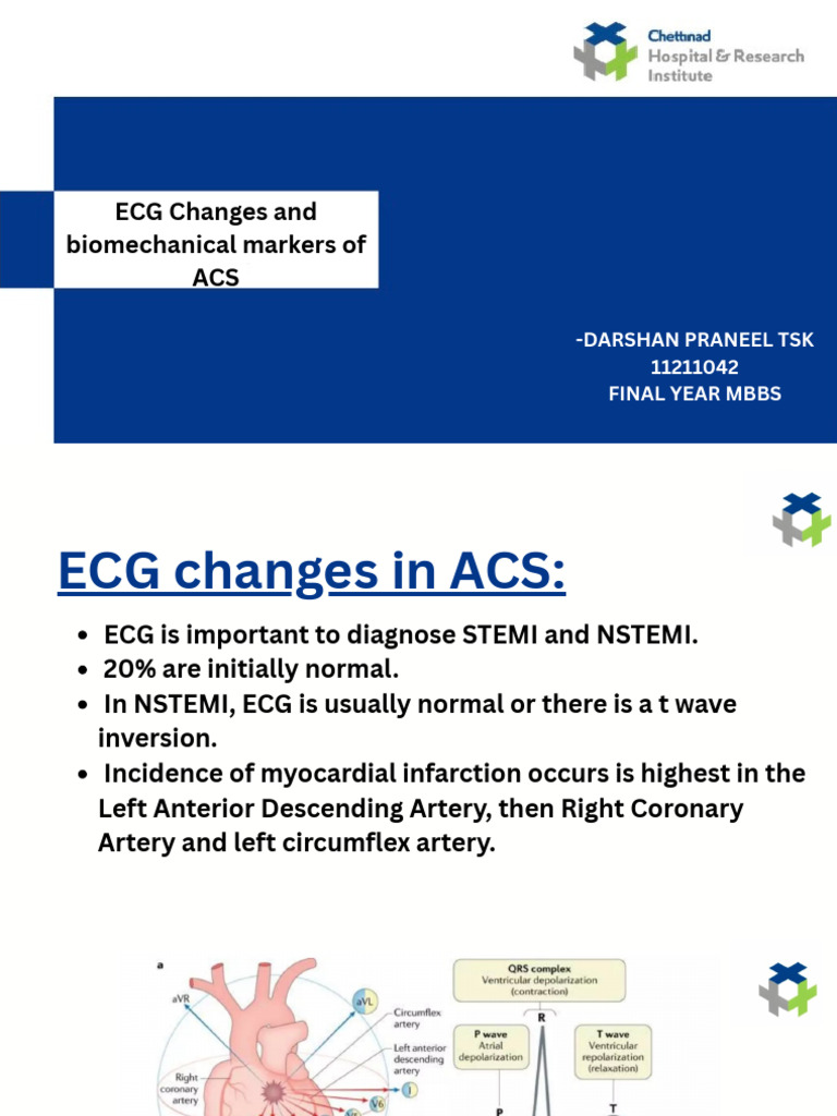 ECG Changes in ACS.pdf | PDF
