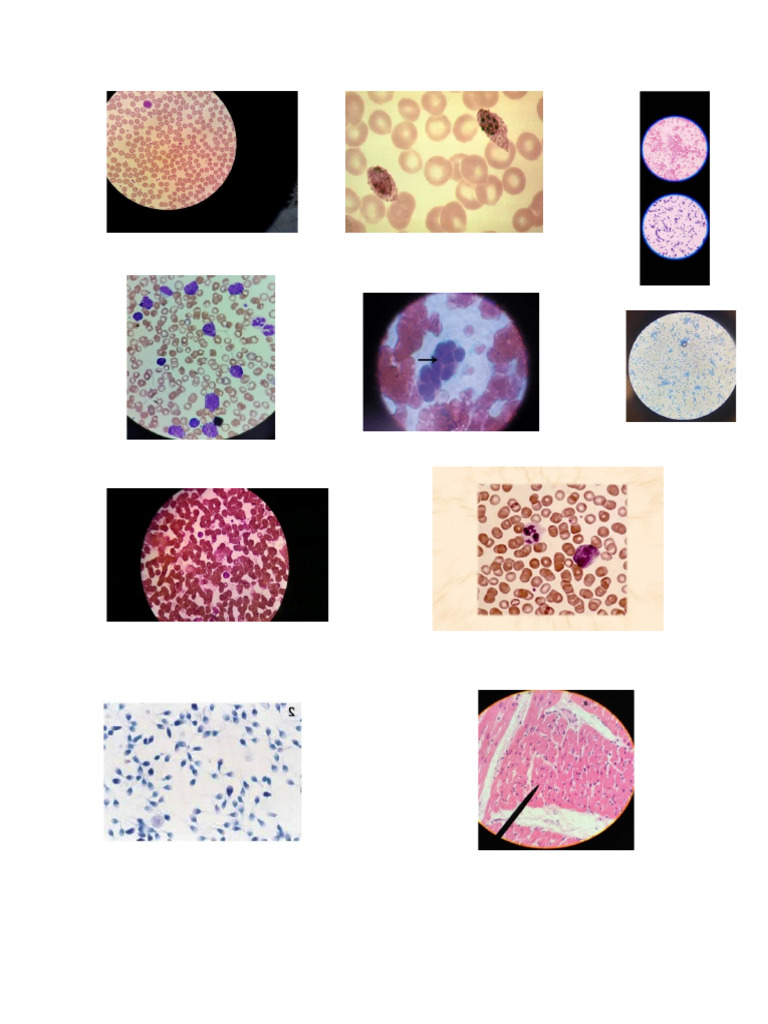 Eritrocitos Basófil (2) | PDF