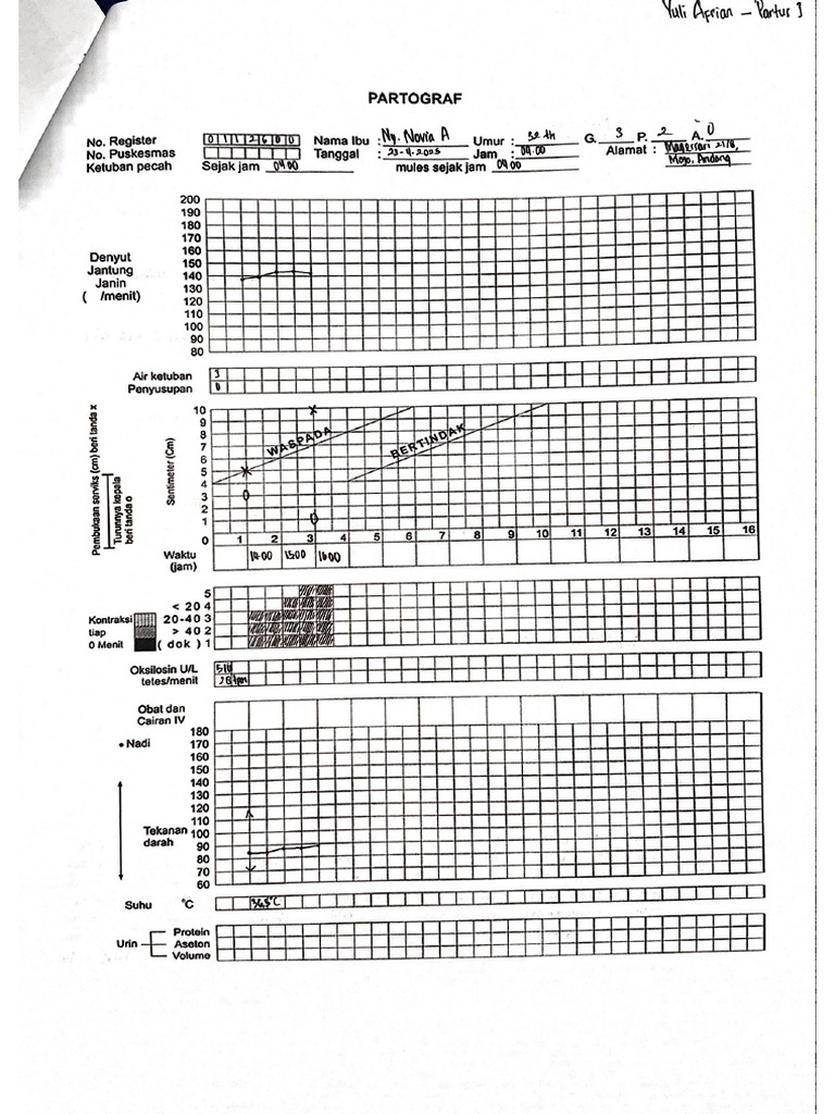 Partograf Yuli Afrian Sari - Partus 1 | PDF