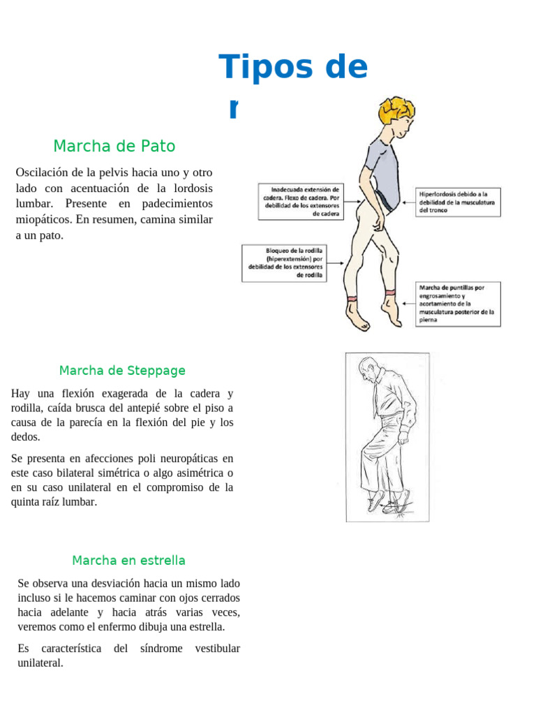 Tipos de Marcha | PDF | Sistema musculoesquelético | Enfermedades y ...