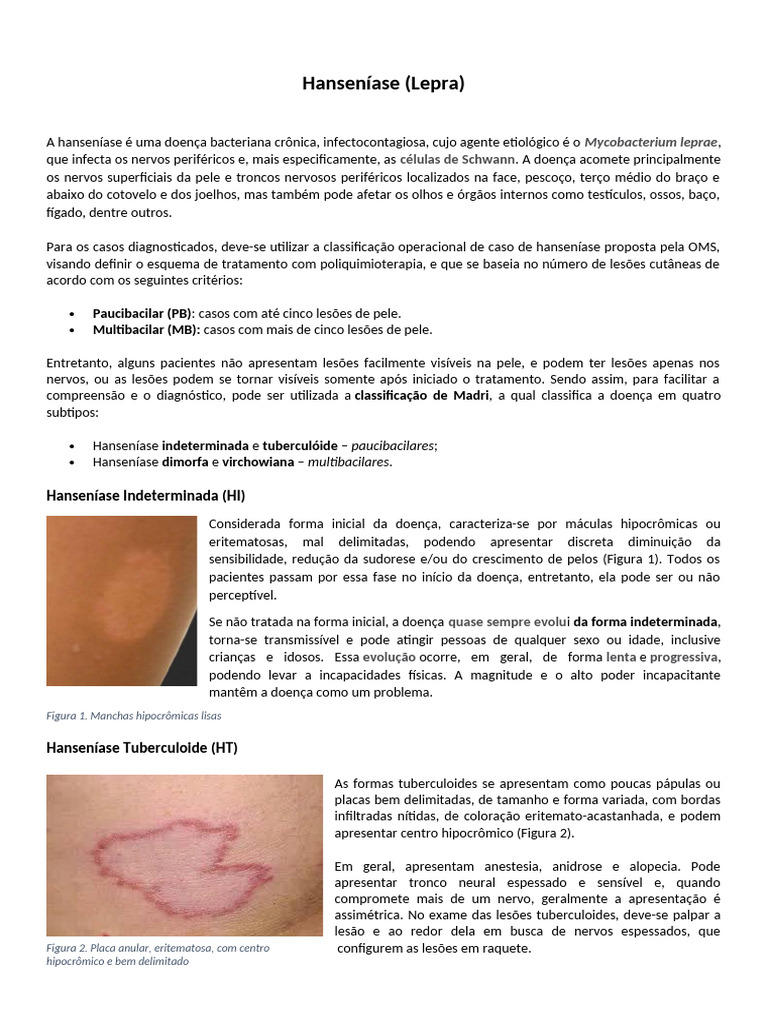 Entendendo a Hanseníase: Tipos e Tratamento | PDF | Lepra ...
