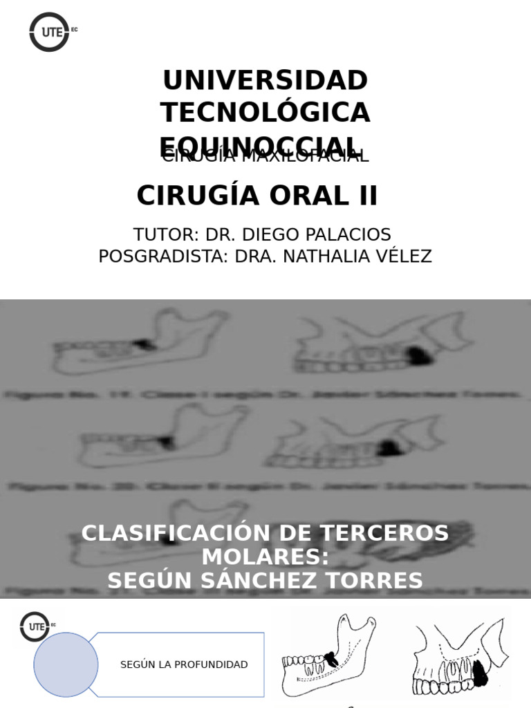 Clasificacion de Terceros Molares, Segun Sanchez Torres, Pell y Gregory, Winter | PDF