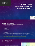 ECG Criteria for STEMI and J-Point | PDF | Electrocardiography ...