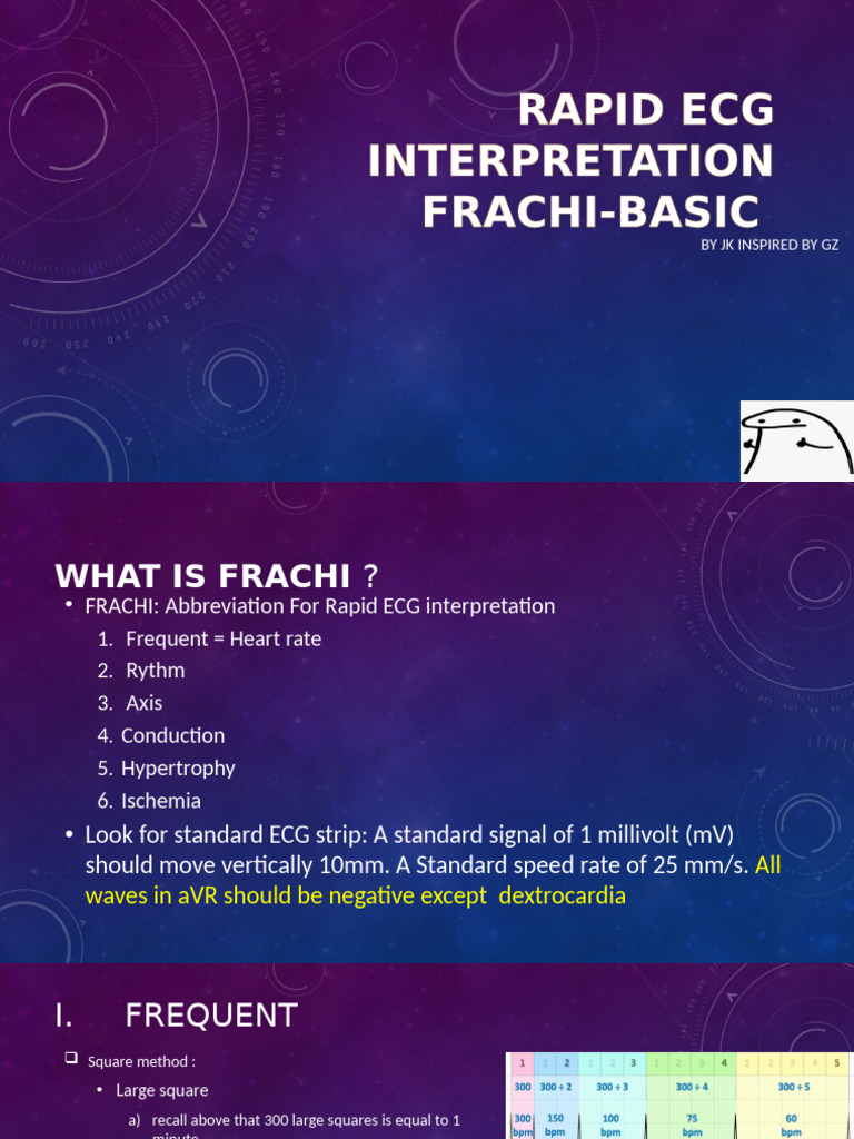 Rapid ECG Interpretation Guide | PDF | Electrocardiography ...