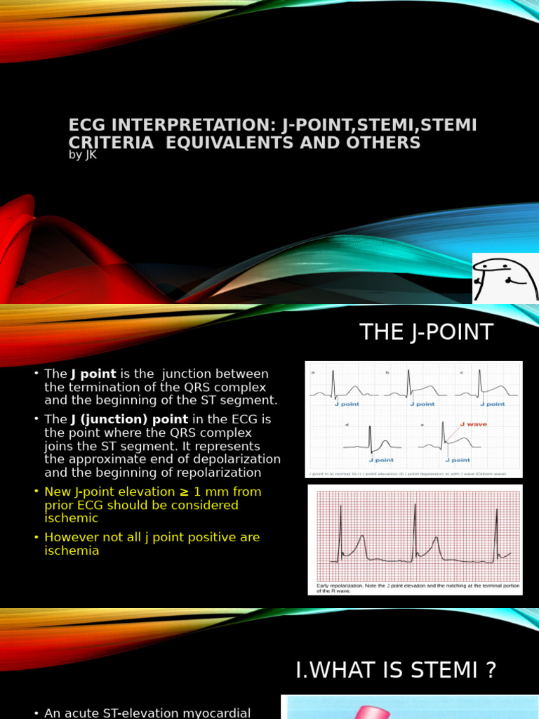 Ecg Interpretation J Point Stemi Criteria Equivalents and Others | PDF | Electrocardiography ...