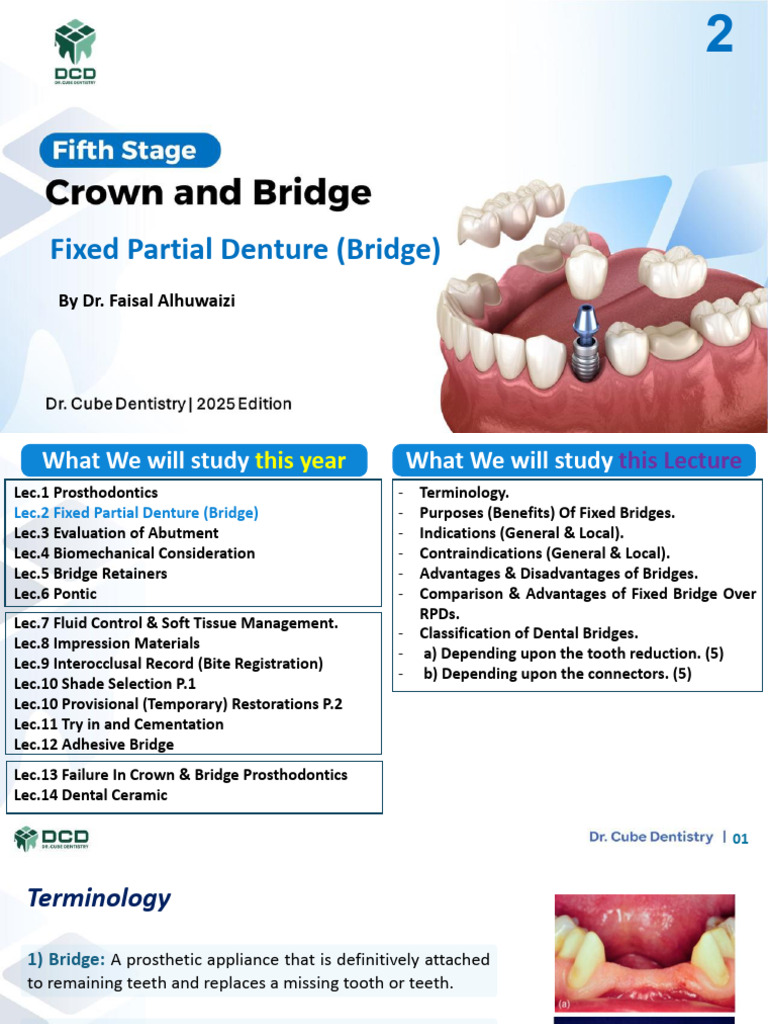 Crown5 Lec.2 Fixed Partial Denture (Bridge) | PDF | Dentistry | Mouth