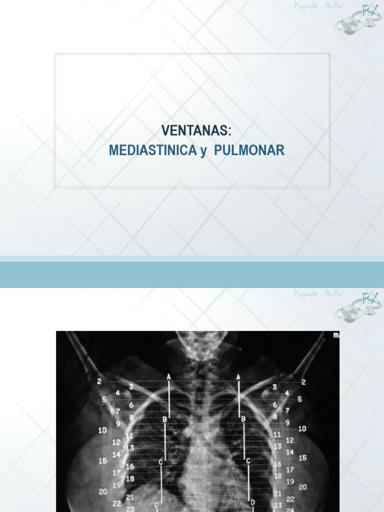 TC Torax Anatomia | PDF