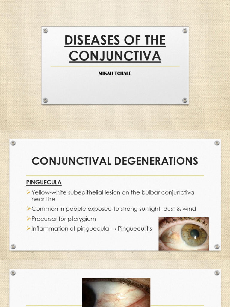 Diseases of The Conjunctiva | PDF | Diseases And Disorders | Medical Specialties