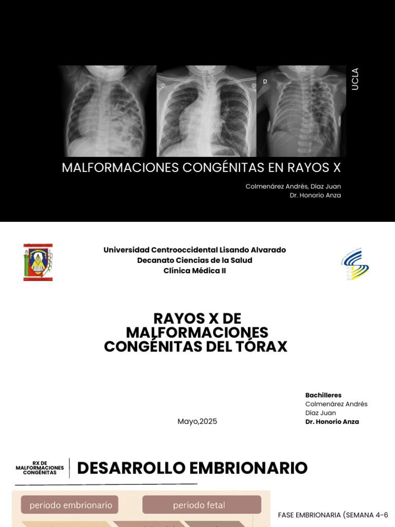 Rayos X de Malformaciones Congénitas | PDF | Pulmón | Tórax