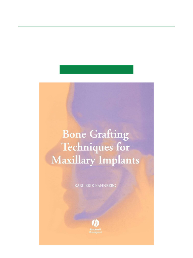 Reader's Pick Bone Grafting Techniques For Maxillary Implants, 1st ...